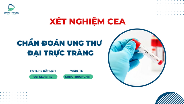 Bệnh viện đa khoa sông thương. Xét Nghiệm CEA – Chẩn Đoán Ung Thư Đại ...