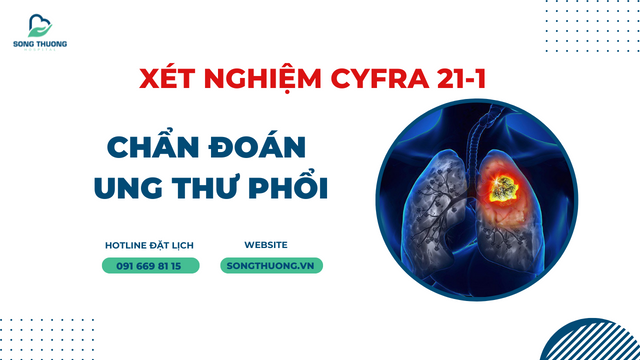 Bệnh viện đa khoa sông thương. Xét Nghiệm CYFRA 21-1 Chẩn Đoán Ung Thư Phổi